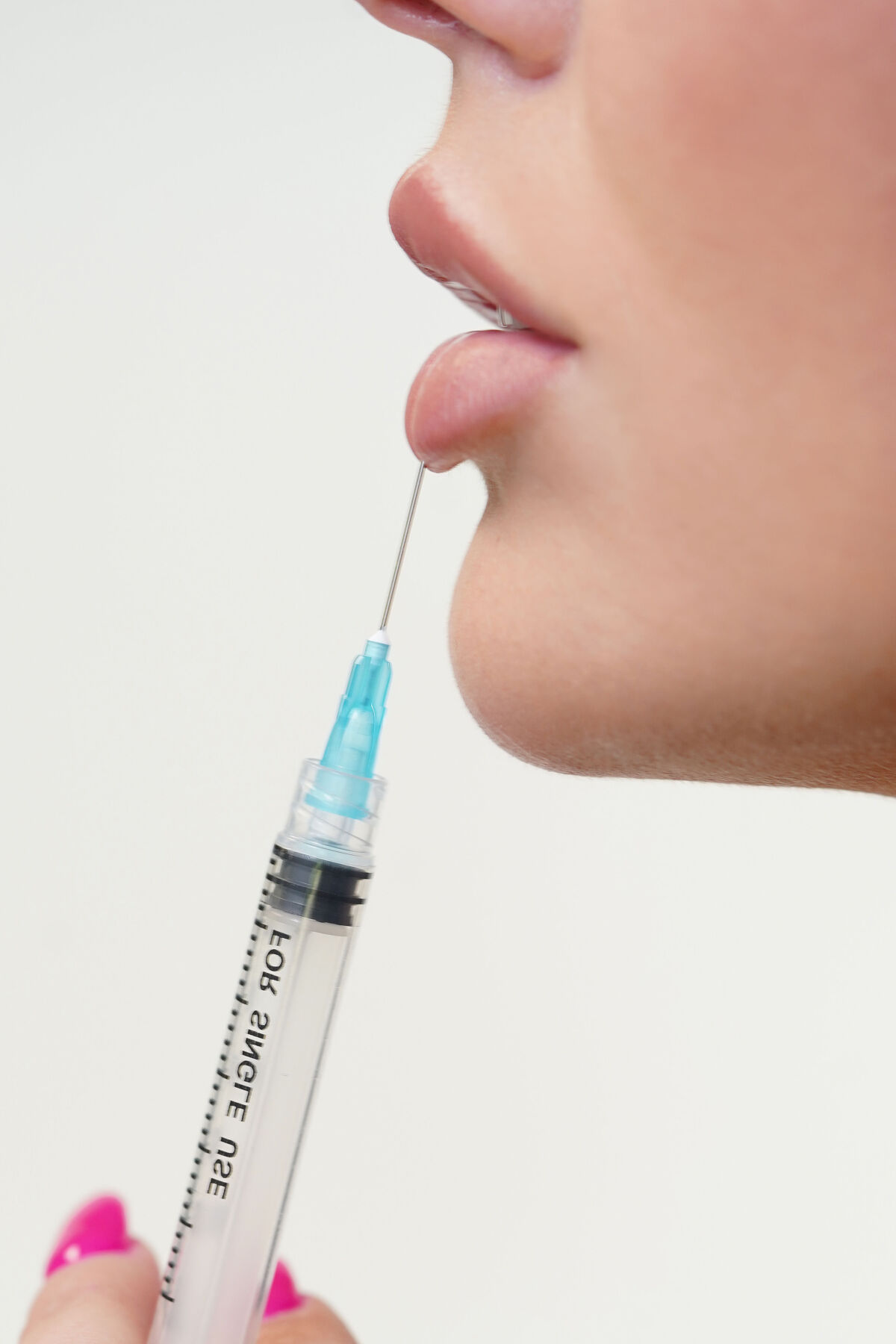 Lip Filler Injections | It's A Secret Med Spa